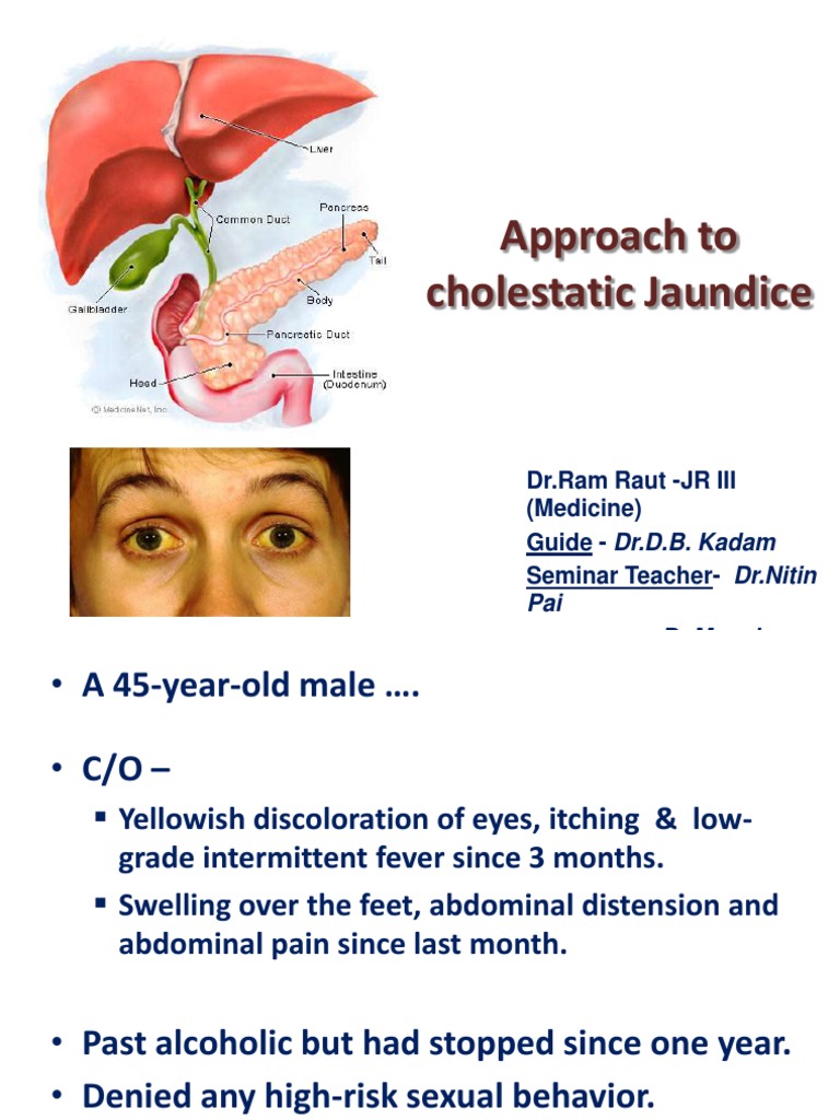 Approach To Cholestatic Jaundice: DR - Ram Raut - JR III (Medicine ...