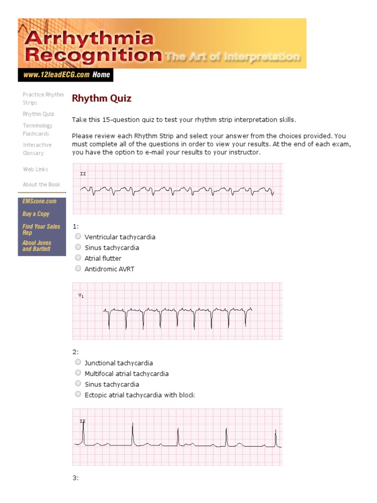 Ecg Quiz | PDF | Cardiovascular System | Physiology