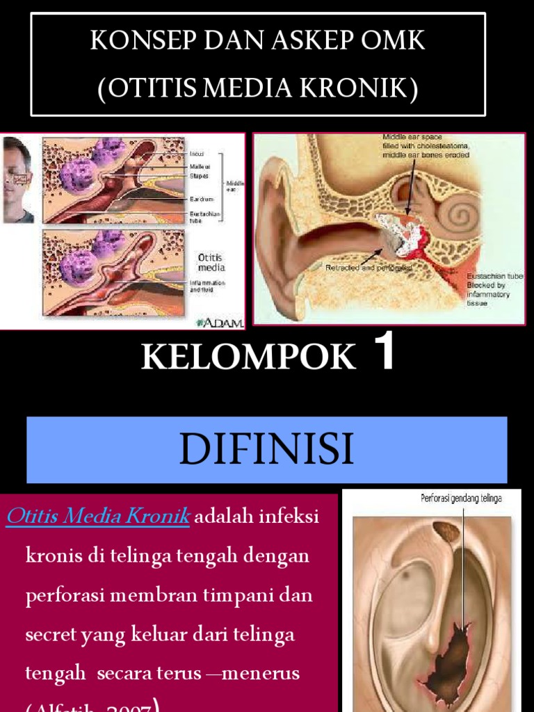 Konsep Dan Askep Omk (Otitis Media Kronik) : Kelompok 1 | PDF