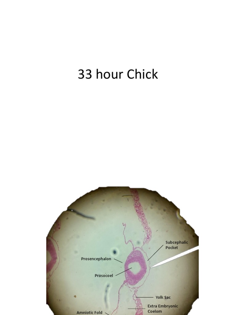 33 Hour Chick Embryo Transverse Section | PDF | Aorta | Organ (Anatomy)