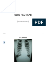 Anatomi Thorax Normal + Gambaran Radiologi | PDF