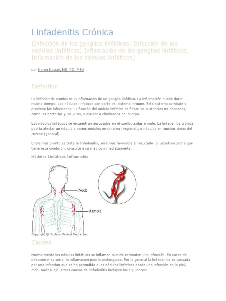 Linfadenitis Crónica | Antibióticos | Influenza | Prueba gratuita de 30 ...