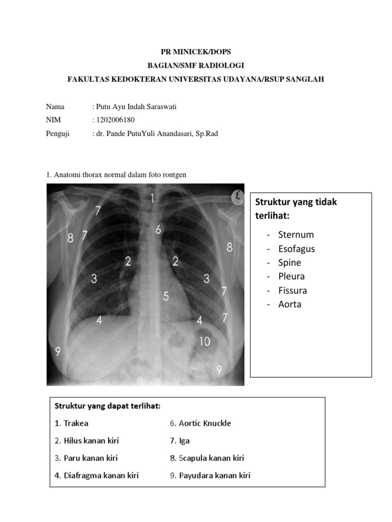 Anatomi Thorax Normal + Gambaran Radiologi | PDF