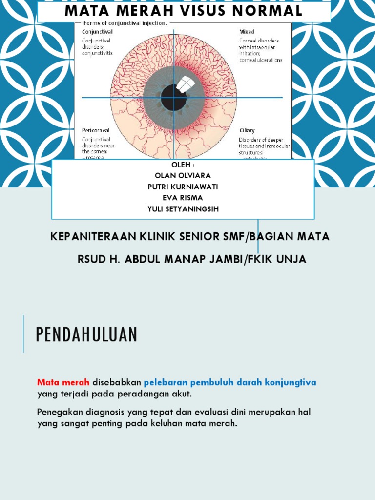 Presentasi Mata Merah Visus Normal | PDF