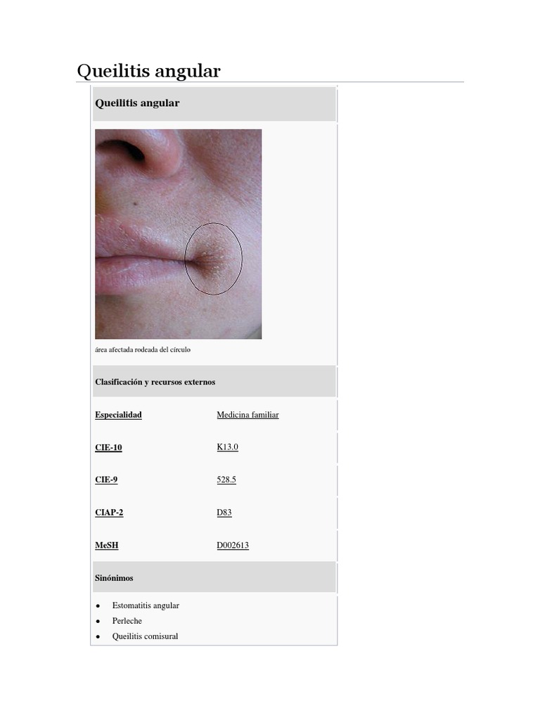 Queilitis Angular | PDF | Especialidades Medicas | Enfermedades y ...