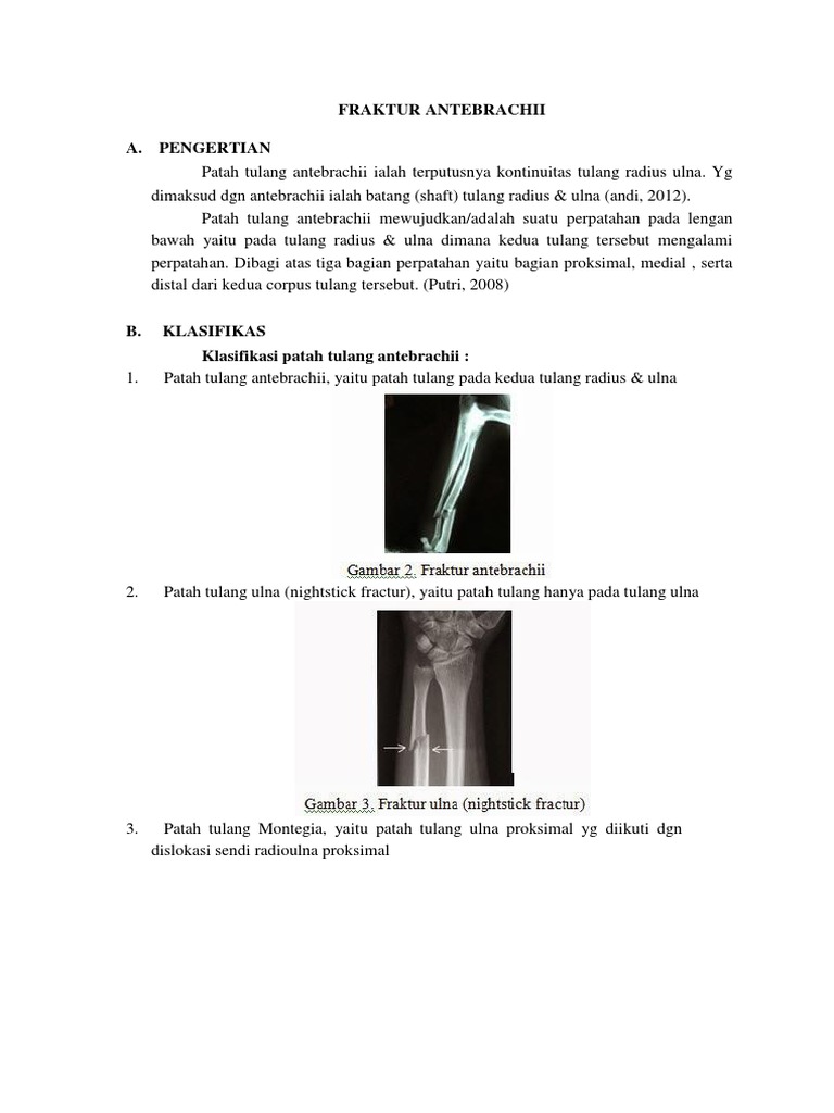 Fraktur Antebrachii Edit | PDF