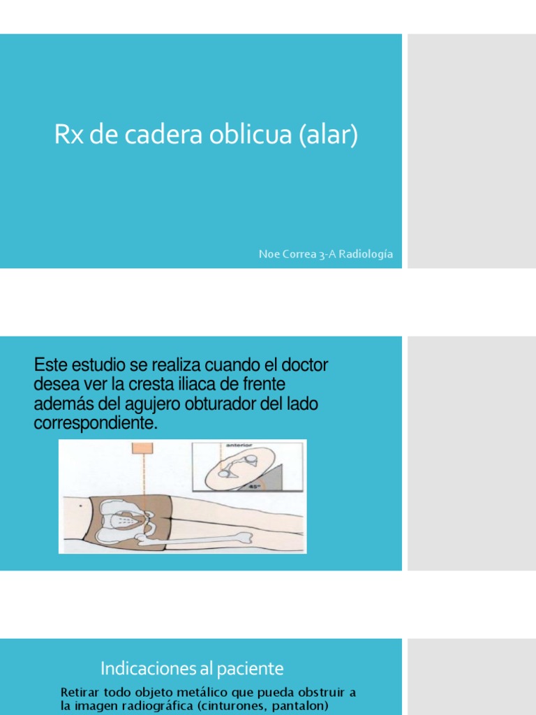 Proyección Alar y Obturatriz de Cadera | PDF