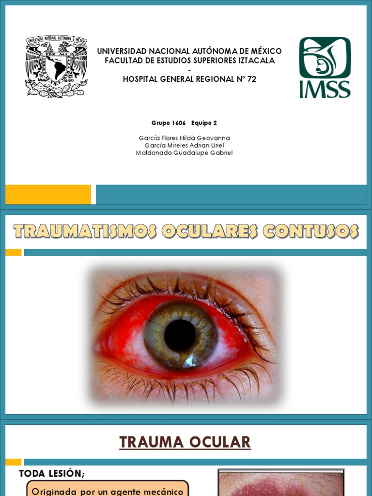 Trauma Ocular Contuso | PDF | Ojo humano | Oftalmología