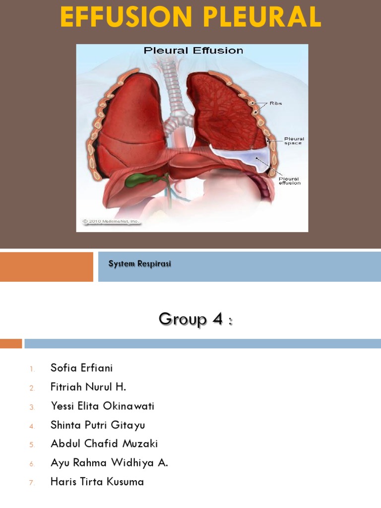 Efusi Pleura Ppt.id.en [Repaired] | Clinical Medicine | Medicine