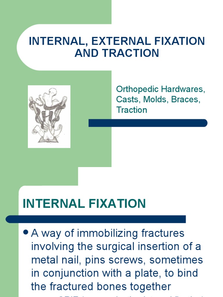 Internal, External Fixation and Traction | PDF | Plaster | Clinical ...