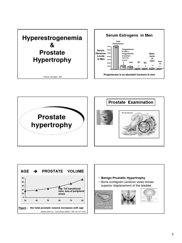 4 & 12. Hyperestrogenemia & Prostate Hypertrophy | PDF | Estradiol ...