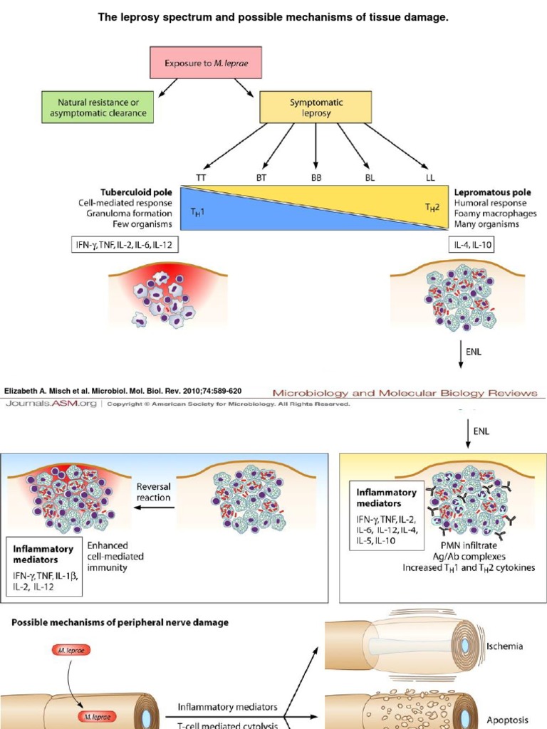 Patofisiologi Morbus Hansen | PDF