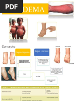 Edema y Signo de Godet | PDF | Edema | Especialidades Medicas
