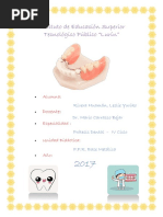 Principios PPR Apoyos, Retenedor Directo e Indirecto | PDF | Dentadura ...