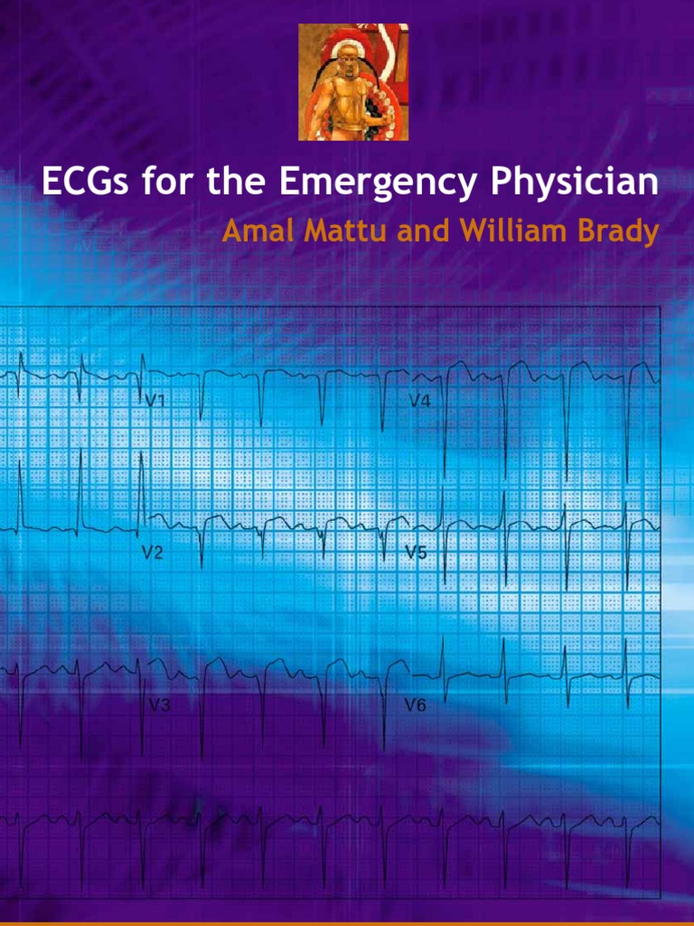 Ecg For Emergency Physician | PDF