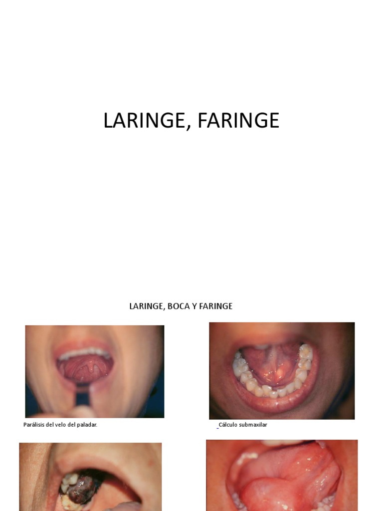 Laringe, Faringe | PDF | Lengua | Medicina