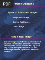 Panoramic Radiograph Anatomy Overview | PDF | Anatomical Terms Of ...