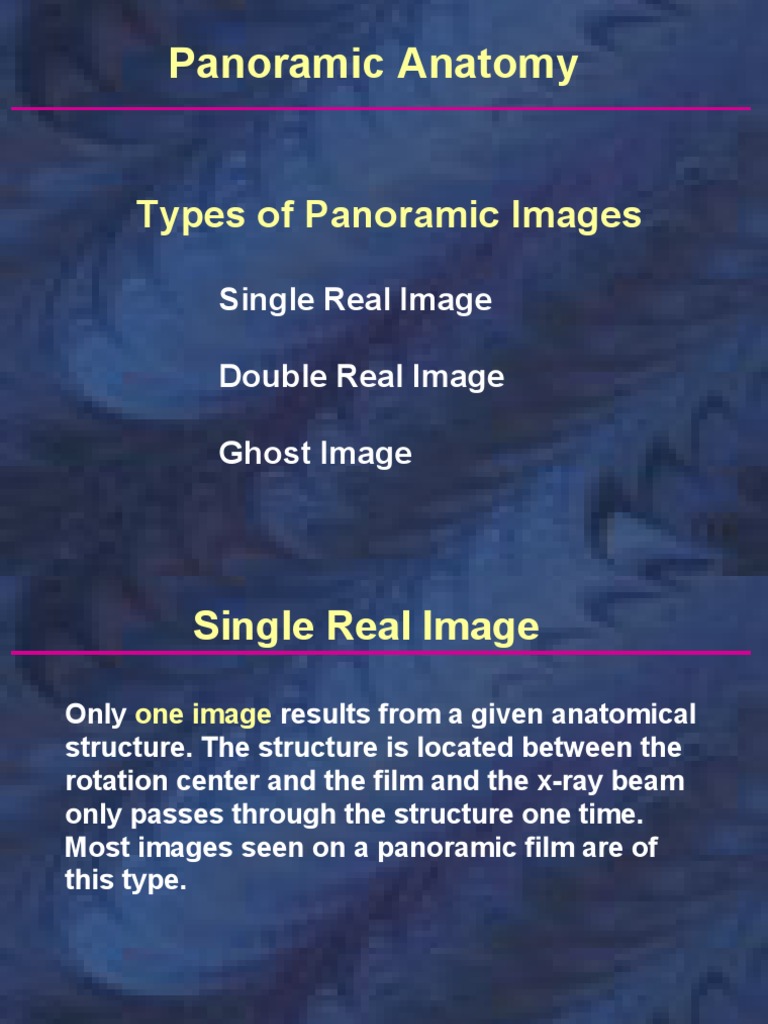 Panoramic Anatomy: Types of Panoramic Images | PDF | Human Anatomy ...