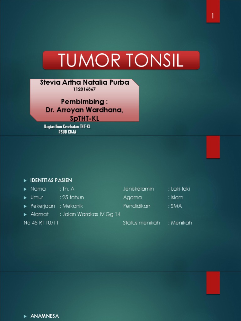 Tumor Tonsil Stevia | PDF