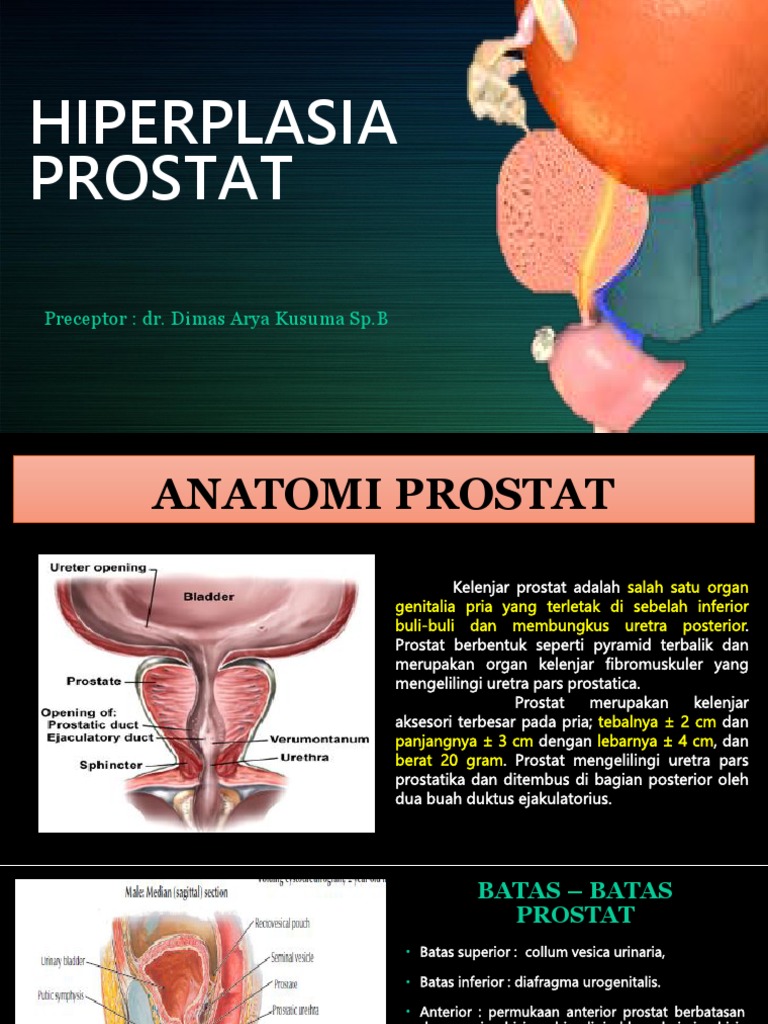 Hiperplasia Prostat | PDF