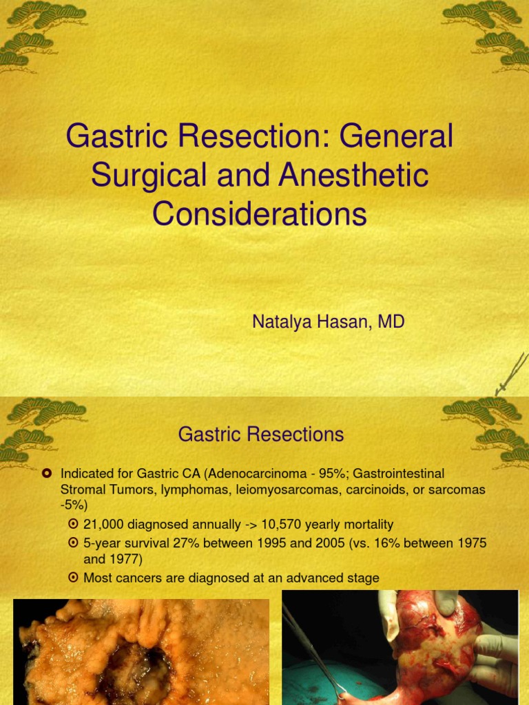 Gastric Resection: General Surgical and Anesthetic Considerations | PDF ...