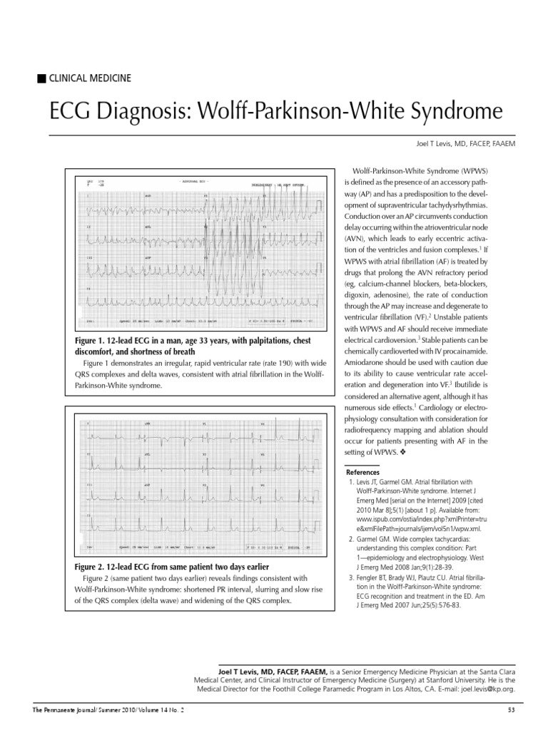 ECG Diagnosis Wolff Parkinson White Syndrome | Cardiac Arrhythmia ...