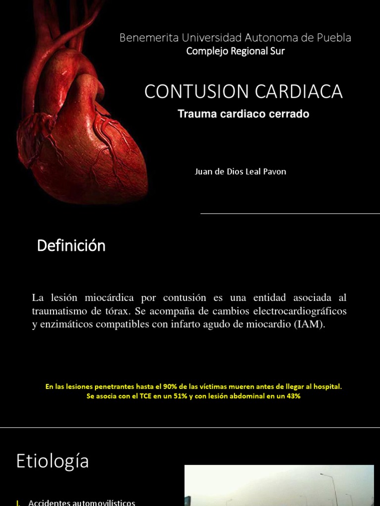 Contusión Cardíaca: Trauma Cerrado | PDF | Lesión | Corazón
