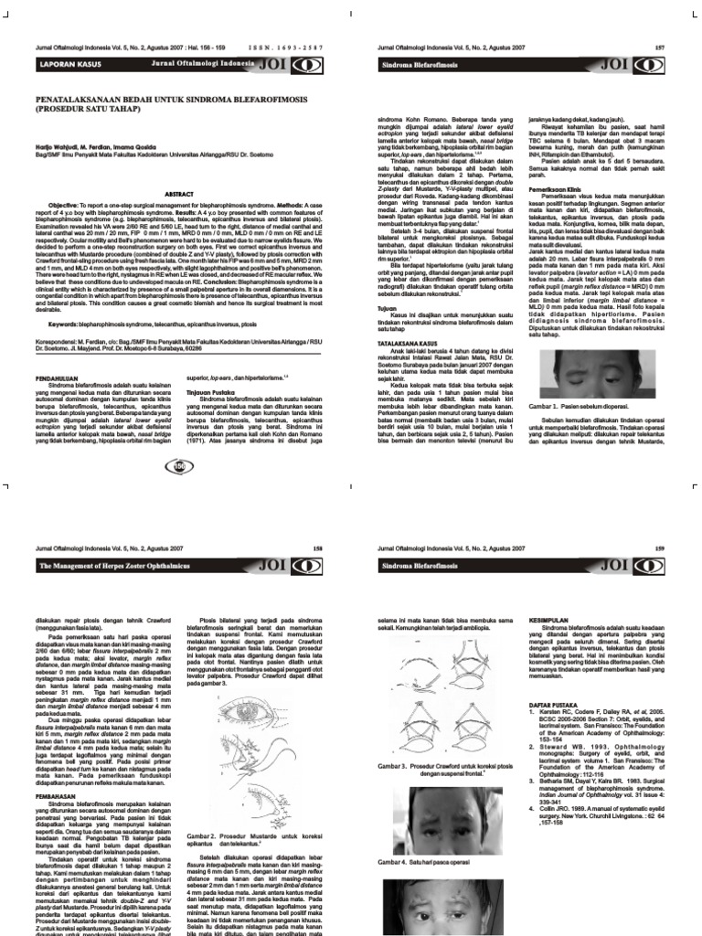Epikantus PDF | PDF
