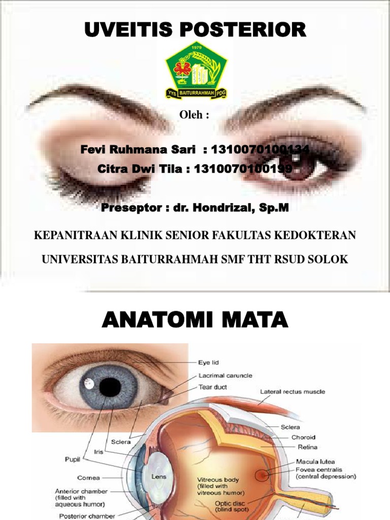 Uveitis | PDF