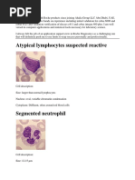 Sysmex KX 21 Histogram Interpretation Handbook | PDF | Anemia | White ...