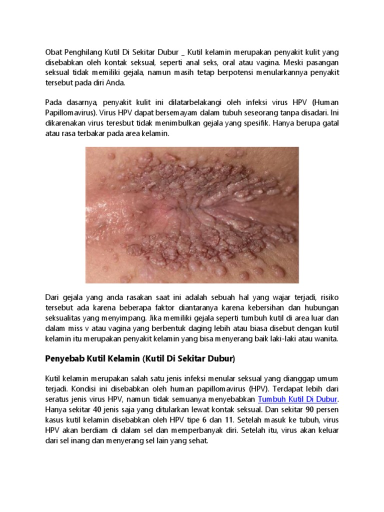 Obat Penghilang Kutil Di Sekitar Dubur | PDF