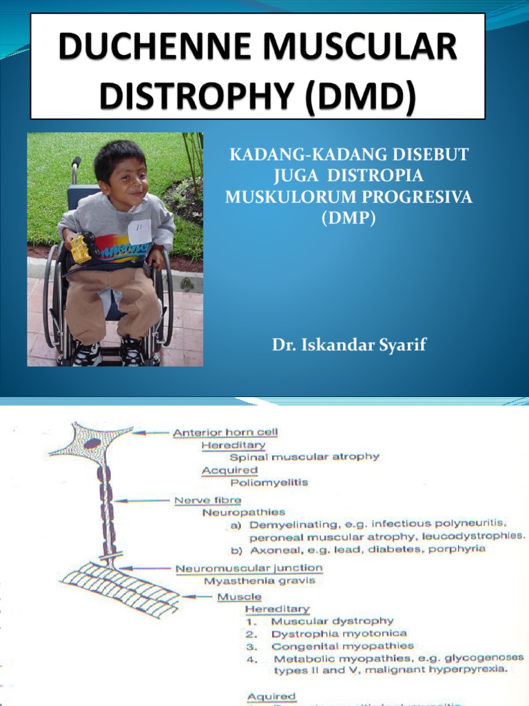 Duchenne Muscular Distrophy (DMD) | PDF