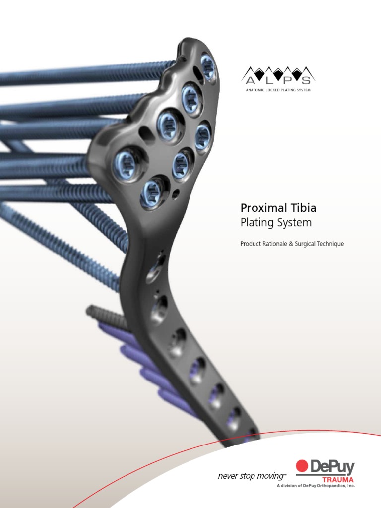 ALPS Proximal Tibia Surgical Technique | PDF | Screw | Anatomical Terms ...