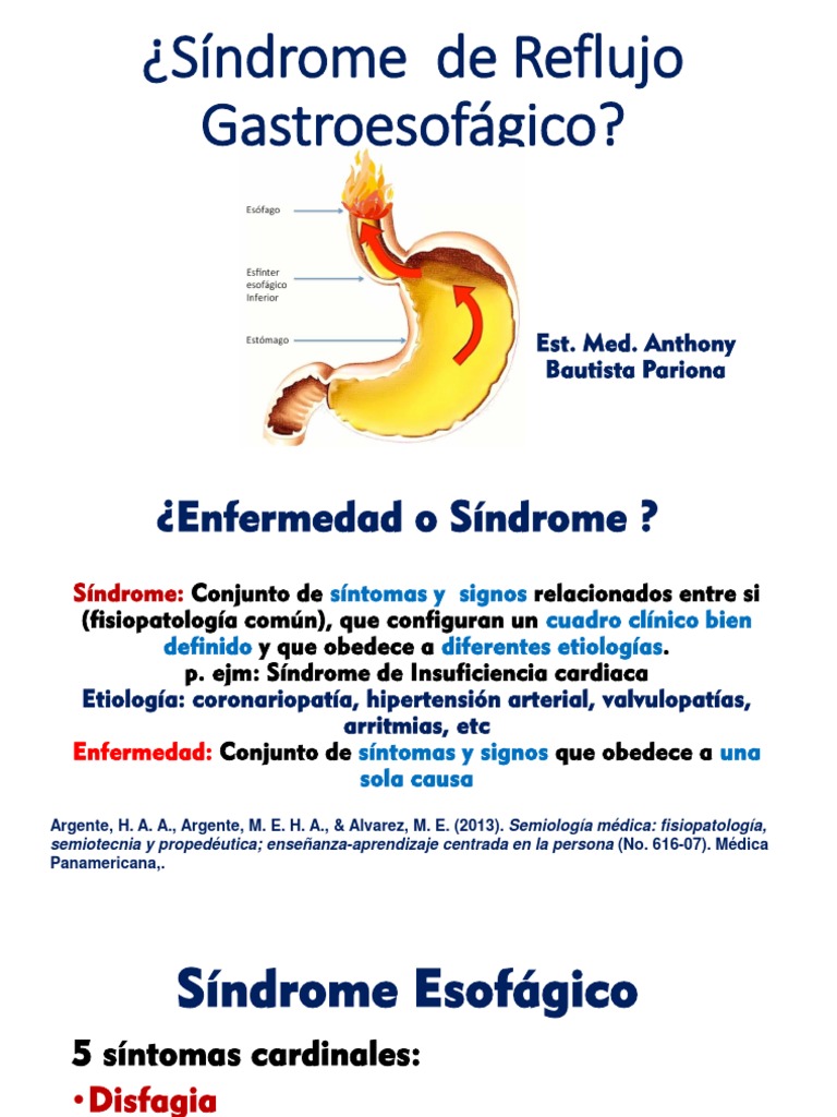 Síndrome de Reflujo Gastroesofágico | Enfermedad del reflujo ...
