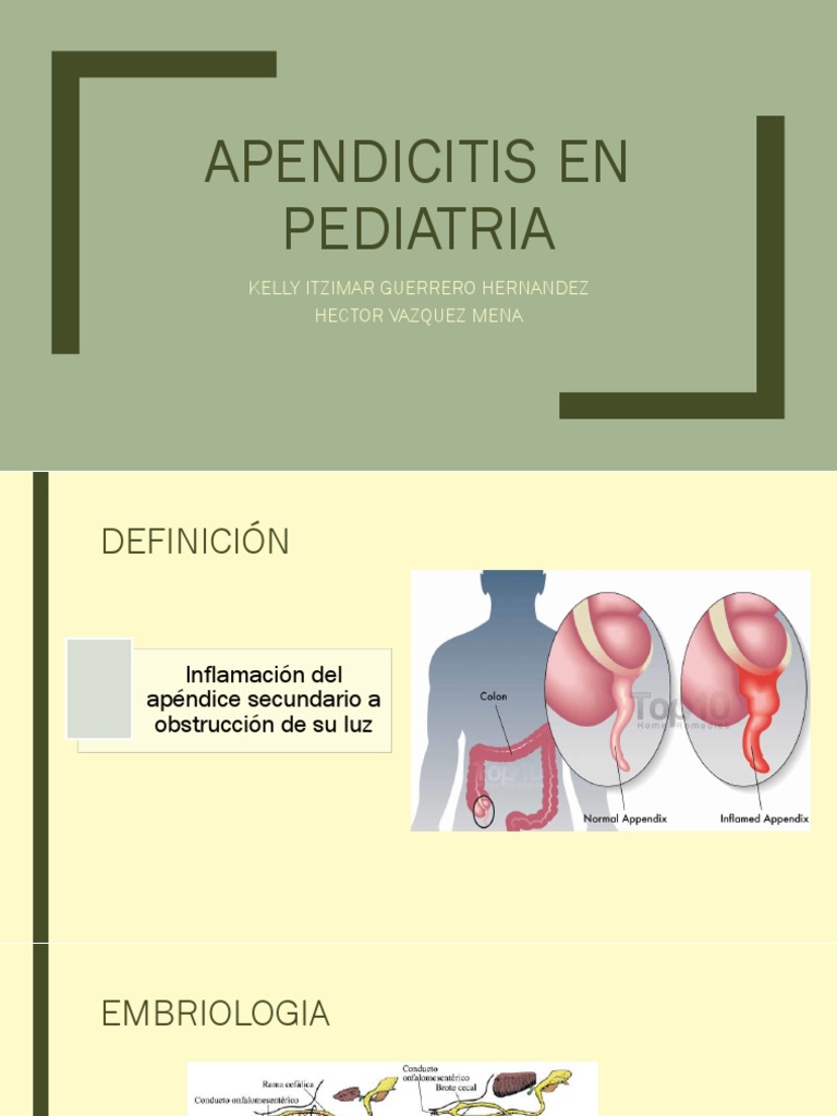 Apendicitis Aguda en Pediatria Completo | PDF | Enfermedades digestivas | Salud pública