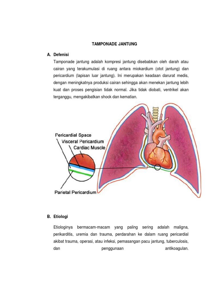 LP Tamponade Jantung | PDF