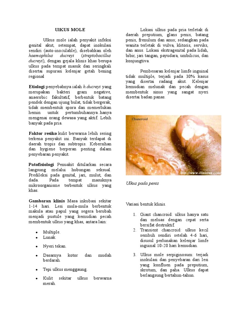 Ulkus Mole, Ulkus Durum, Herpes | PDF