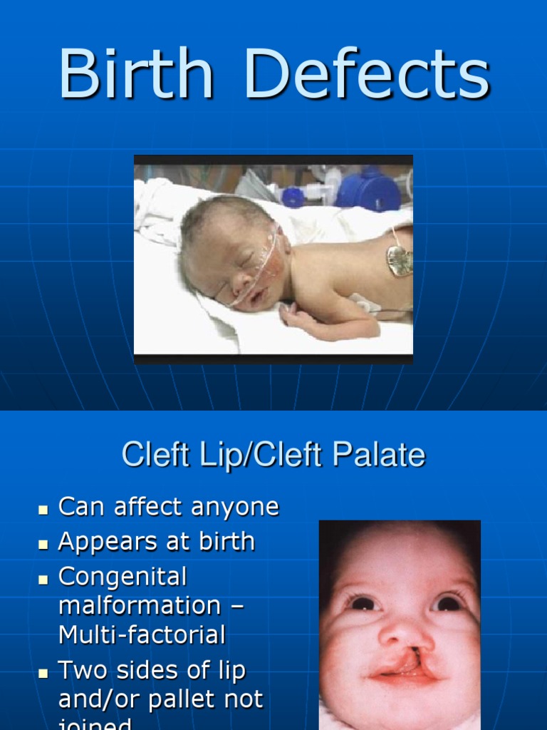 Birth Defects | PDF | Congenital Disorder | Pediatrics
