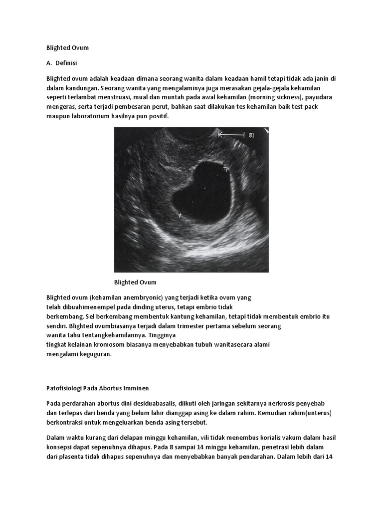 Blighted Ovum | PDF