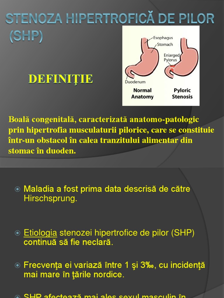 Stenoza Hipertrofică de Pilor | PDF