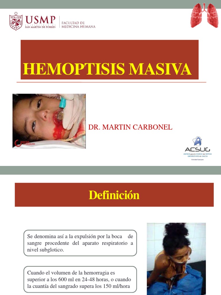 Hemoptisis 2017 Final | PDF | Especialidades Medicas | Medicina CLINICA