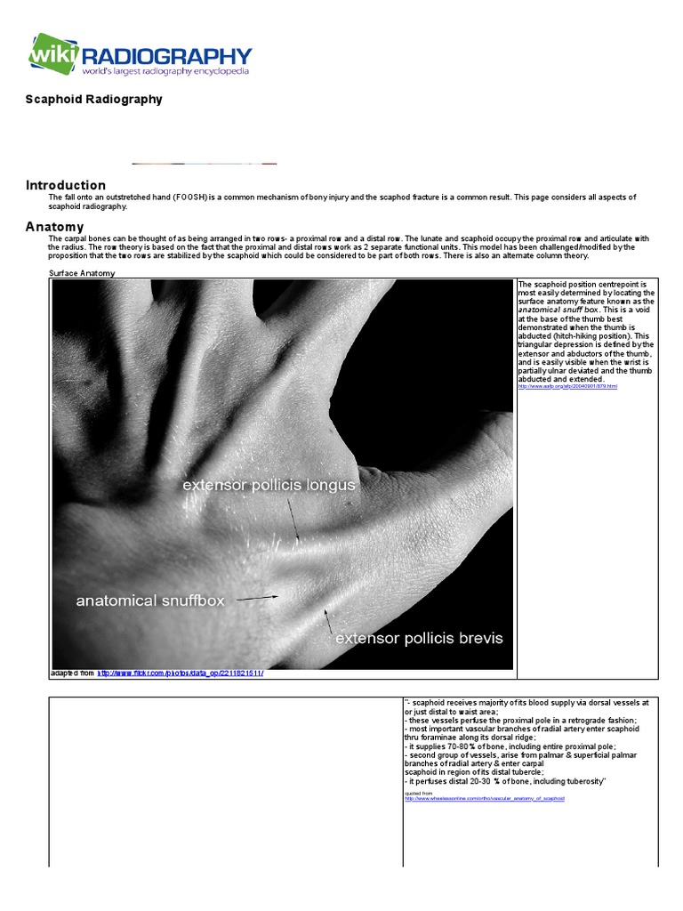 Scaphoid Radiography - WikiRadiography | PDF | Thumb | Limbs (Anatomy)