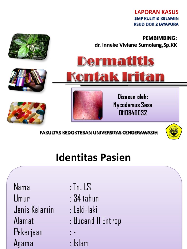Dermatitis Kontak Iritan | PDF