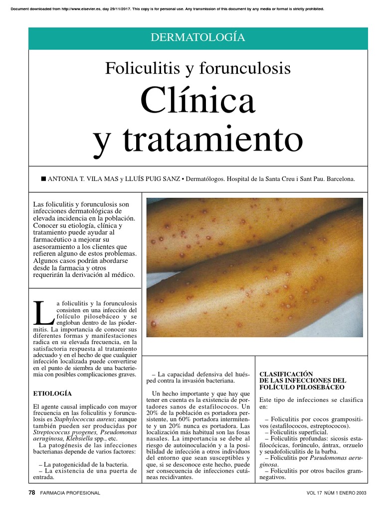 Foliculitis y forunculosis Clínica y tratamiento | Antibióticos ...