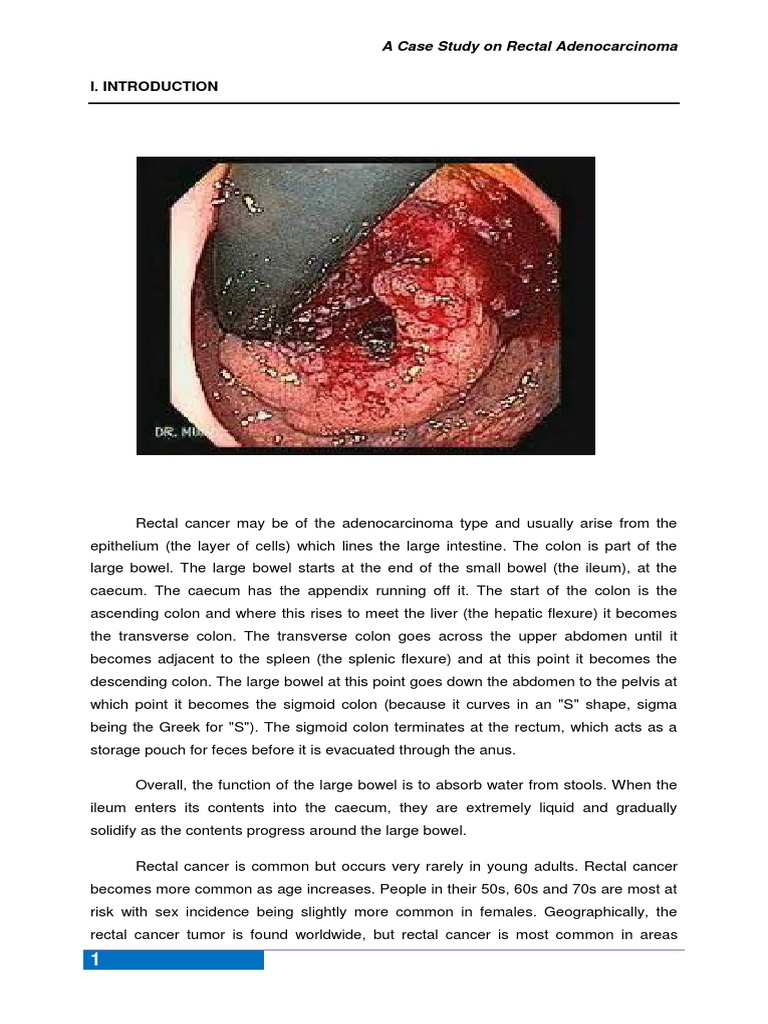 38688220 a Case Study on Rectal Adenocarcinoma | Colorectal Cancer ...