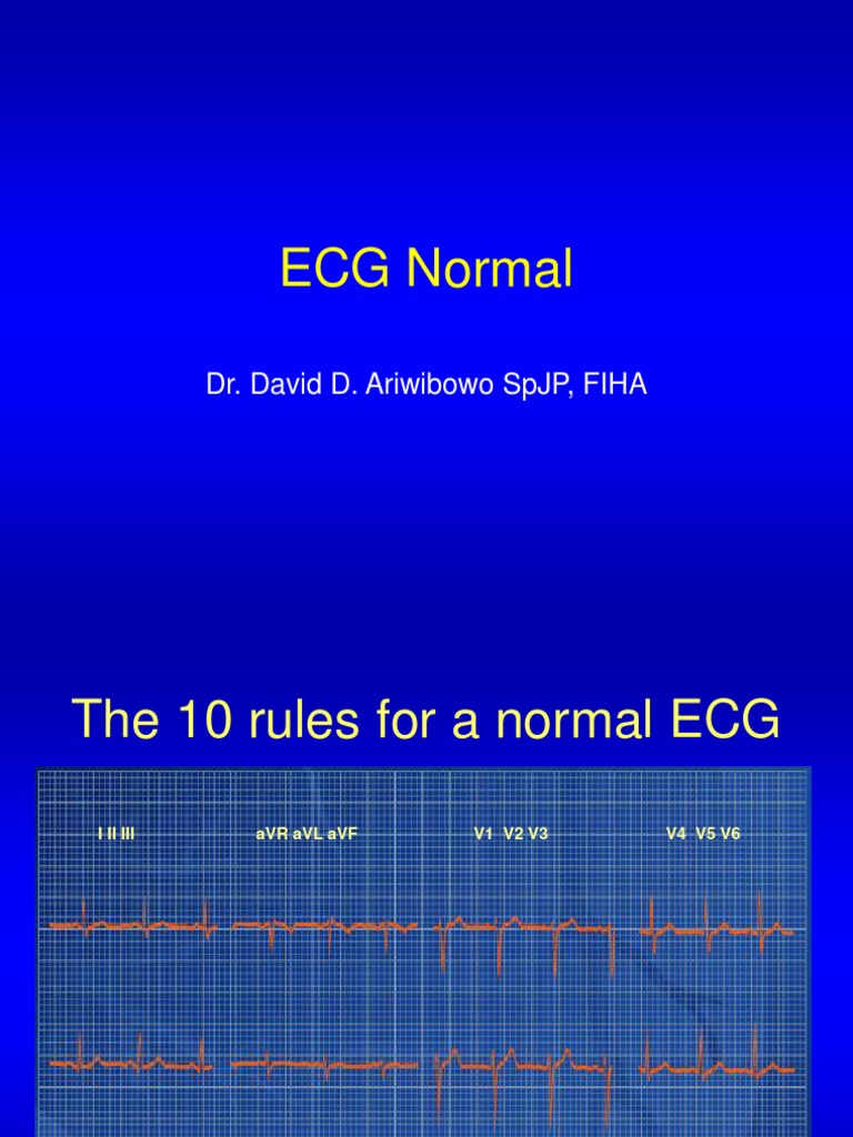 The Ten Rules for a Normal ECG: Identifying Key Characteristics of ...