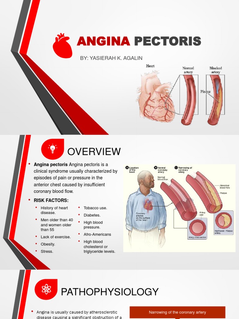 MINI CP Angina Pectoris | PDF | Medical Specialties | Cardiovascular System