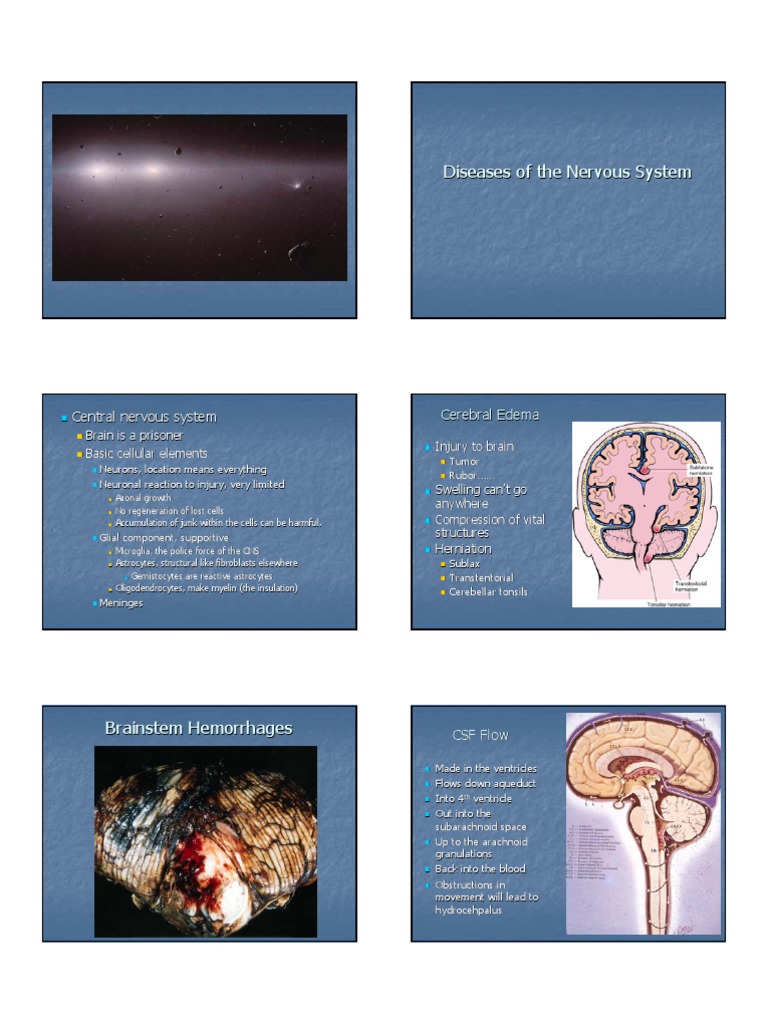 Understanding Diseases of the Central Nervous System | PDF ...