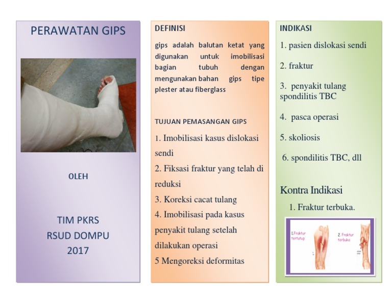 Gips | PDF