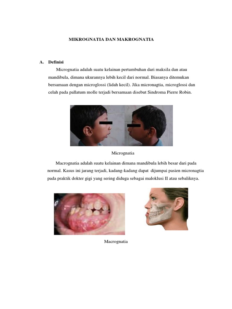 Makrognatia Mikrognatia | PDF